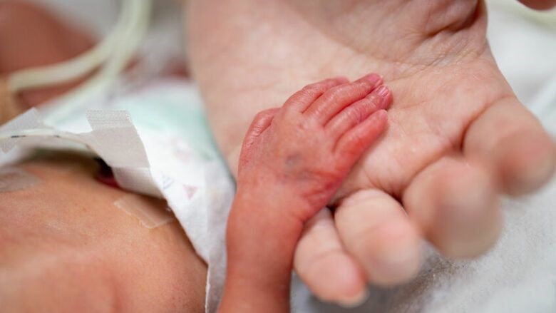 Premature babies: 9 must-know facts | George Herald