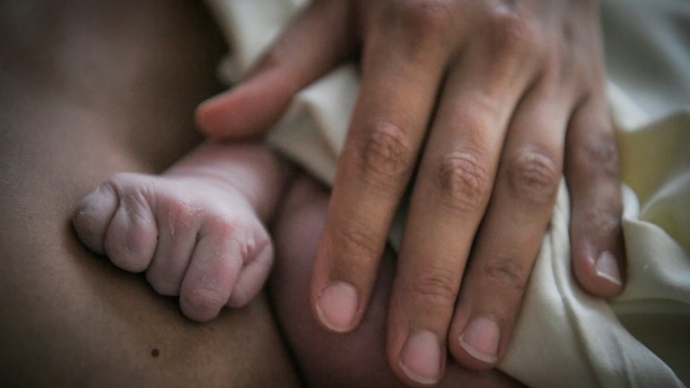 11 more cases of babies born with deformed arms in France | Mossel Bay ...