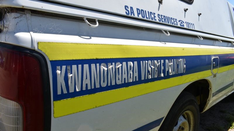 Father of child hit in alleged drunk driving incident speaks | Mossel Bay Advertiser