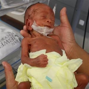 Broeikaste vir babas red lewens | George Herald