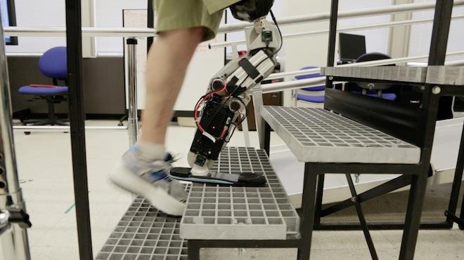 'Thought-controlled prosthetic limbs within reach' | George Herald 'Thought-controlled prosthetic limbs within reach' | George Herald