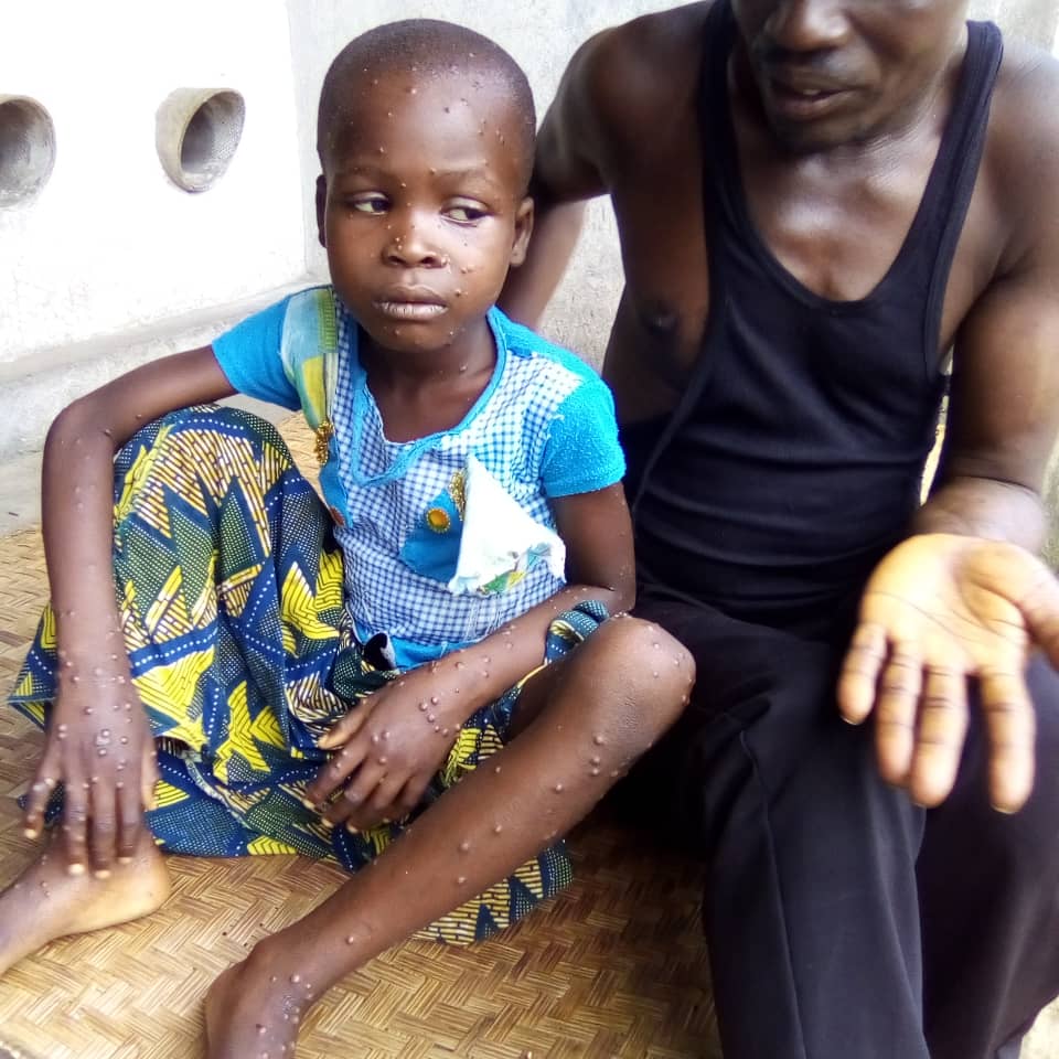 Preventative measures to stop the transmission of monkeypox to animals ...